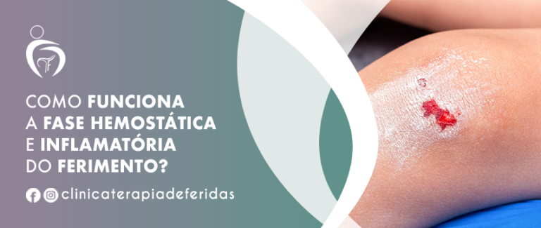 Como funciona a fase hemostática e inflamatória do ferimento? – Terapia ...